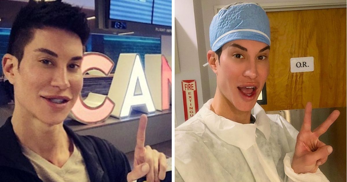 Justin Jedlica, el nuevo 'Ken humano' completó mil cirugías