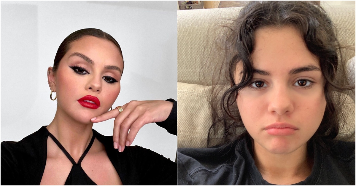 Selena Gomez admitió usar bótox a sus 31 años